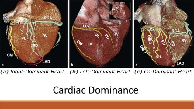 Coronary Angiography and PTCA | PPTX