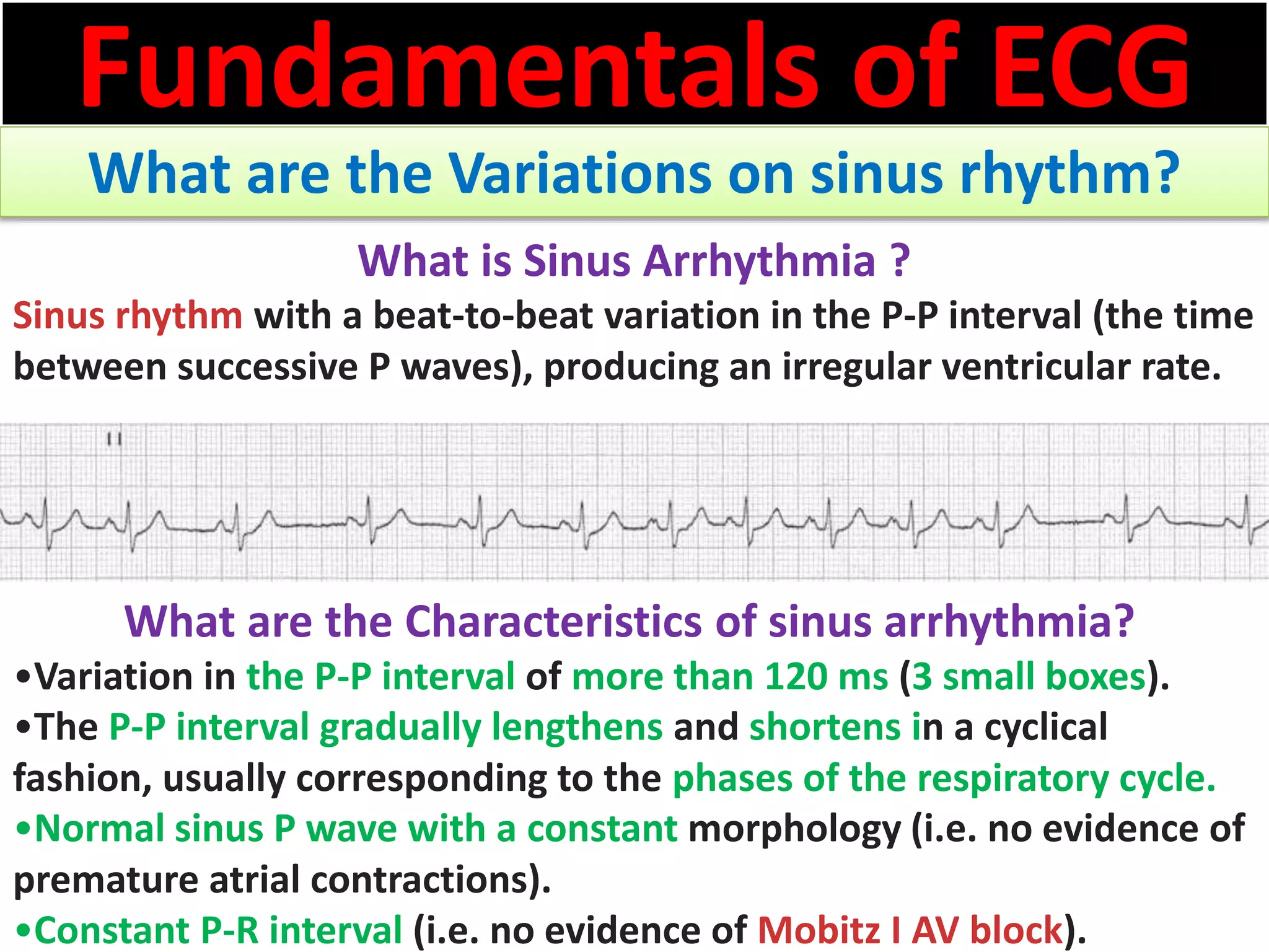 Approach to a patient with Heart rate abnormality in ECG | PPSX