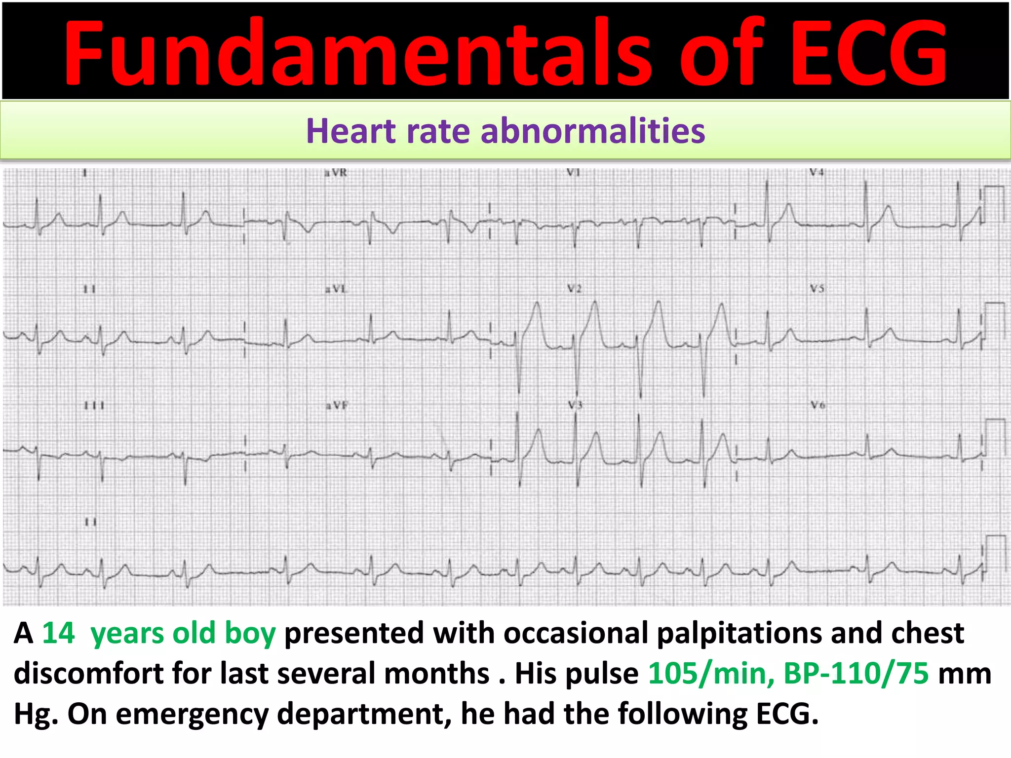 Approach to a patient with Heart rate abnormality in ECG | PPSX