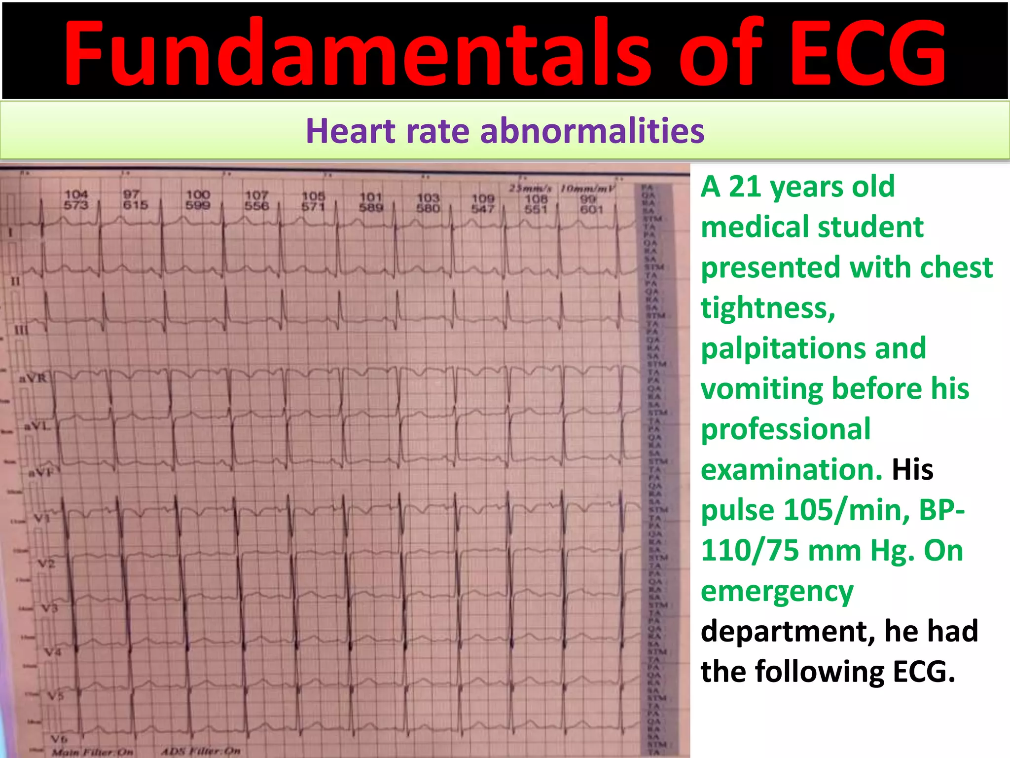 Approach to a patient with Heart rate abnormality in ECG | PPSX