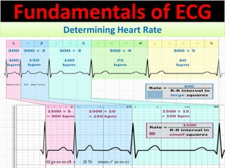 Approach to a patient with Heart rate abnormality in ECG | PPSX