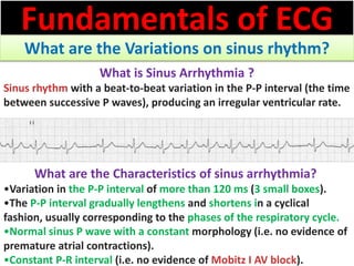 Approach to a patient with Heart rate abnormality in ECG | PPSX