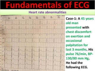 Approach to a patient with Heart rate abnormality in ECG | PPT