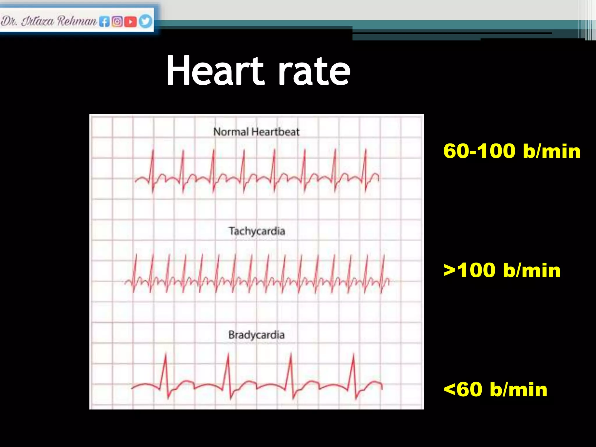Heart rate calculation by Arterial Pulses.pptx