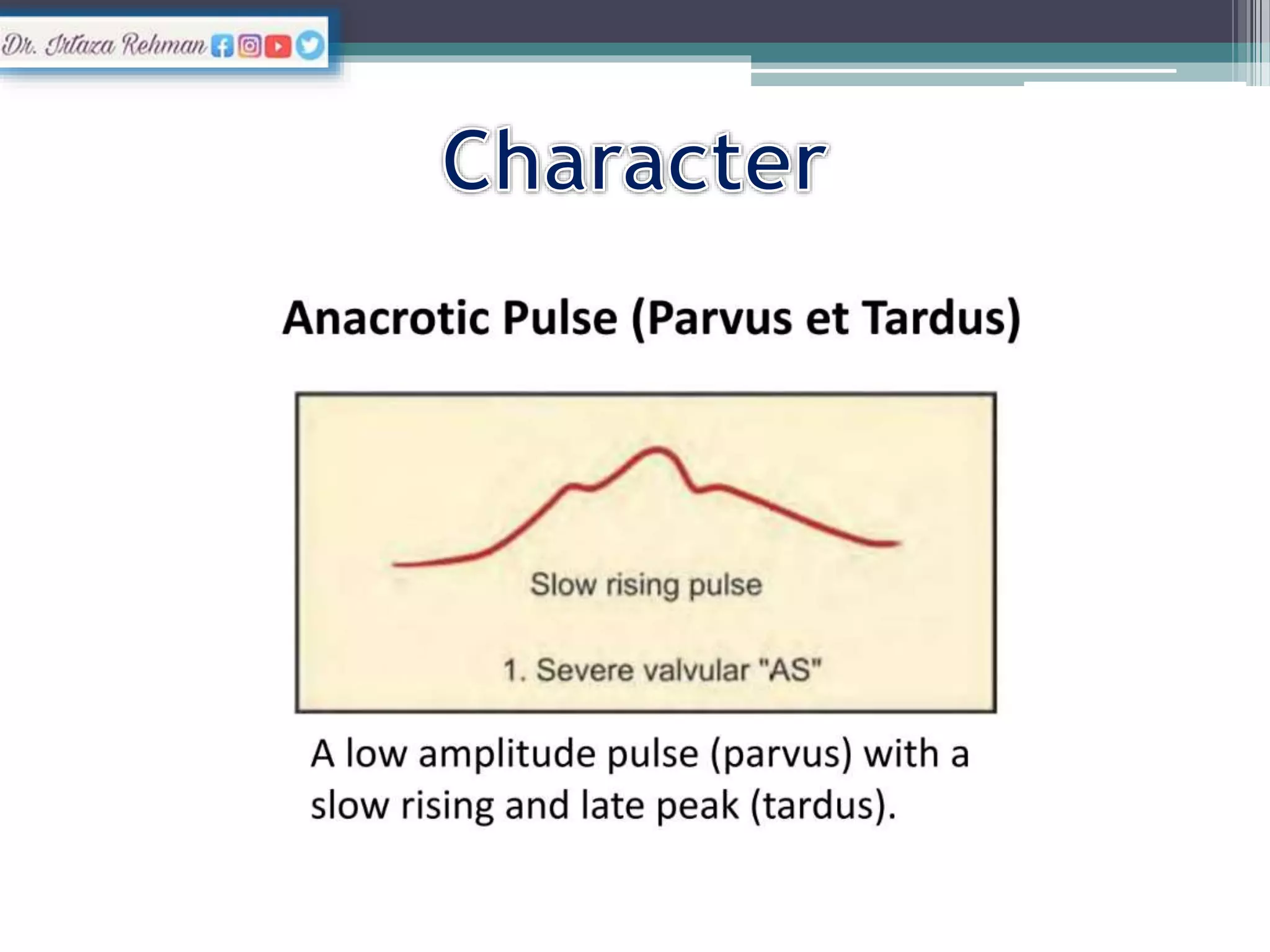 Heart rate calculation by Arterial Pulses.pptx