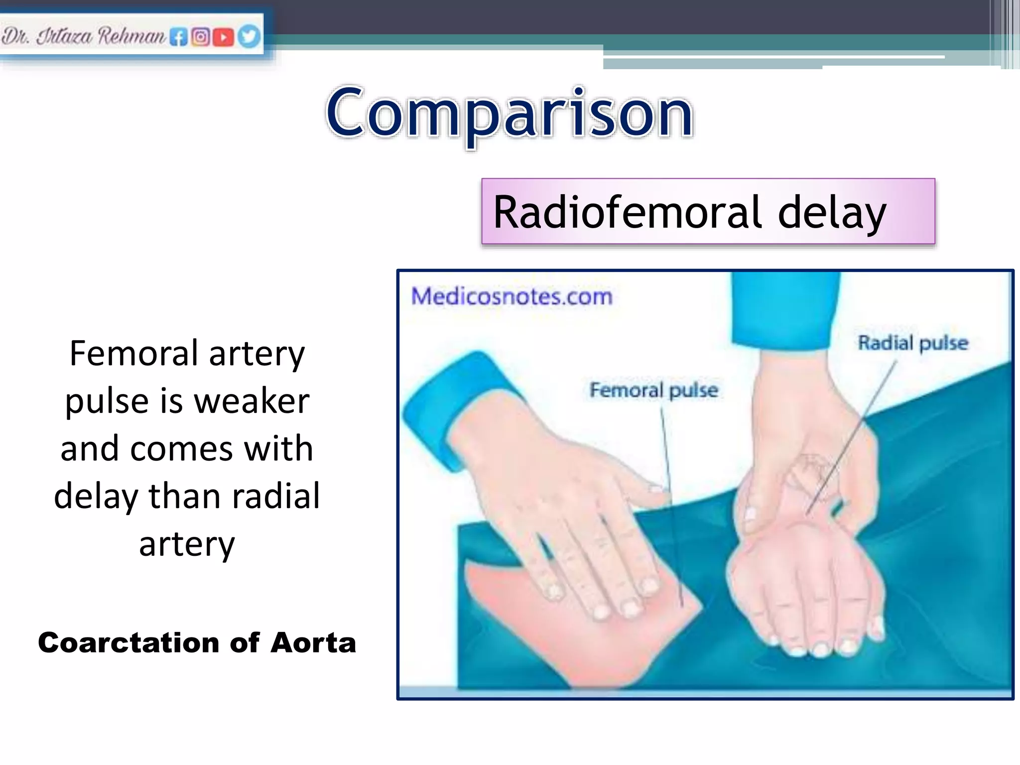 Heart rate calculation by Arterial Pulses.pptx