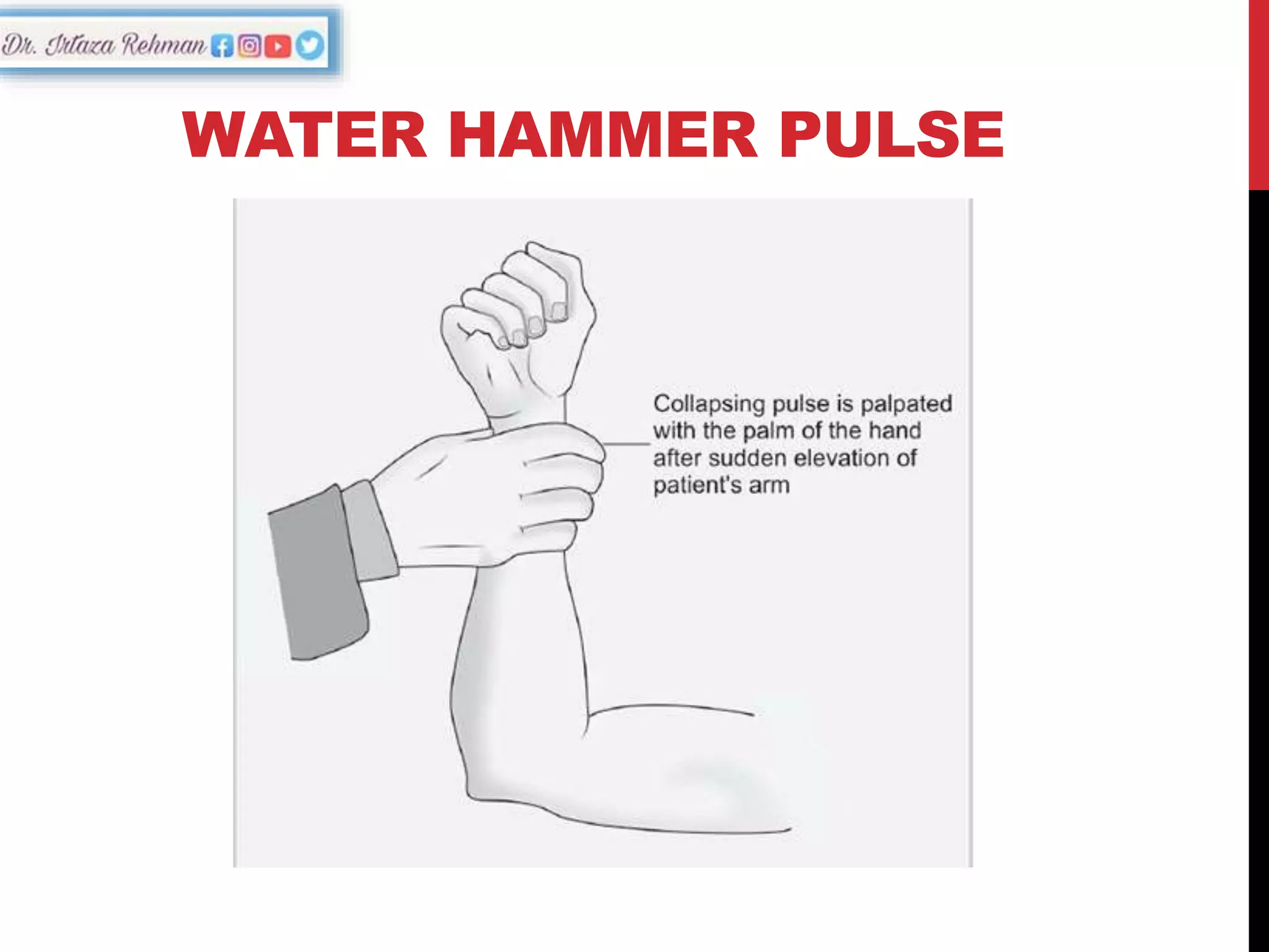 Heart rate calculation by Arterial Pulses.pptx