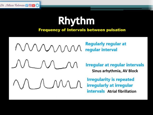Heart rate calculation by Arterial Pulses.pptx