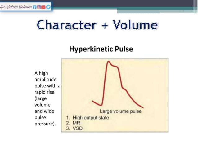 Heart rate calculation by Arterial Pulses.pptx