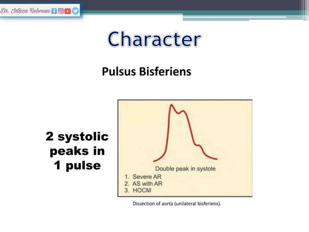 Heart rate calculation by Arterial Pulses.pptx