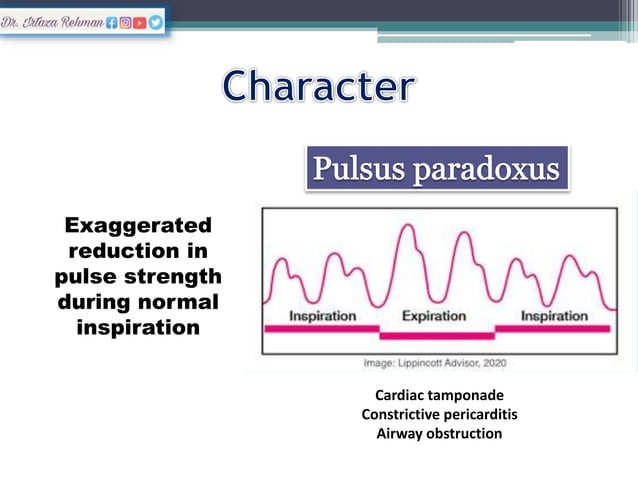 Heart rate calculation by Arterial Pulses.pptx
