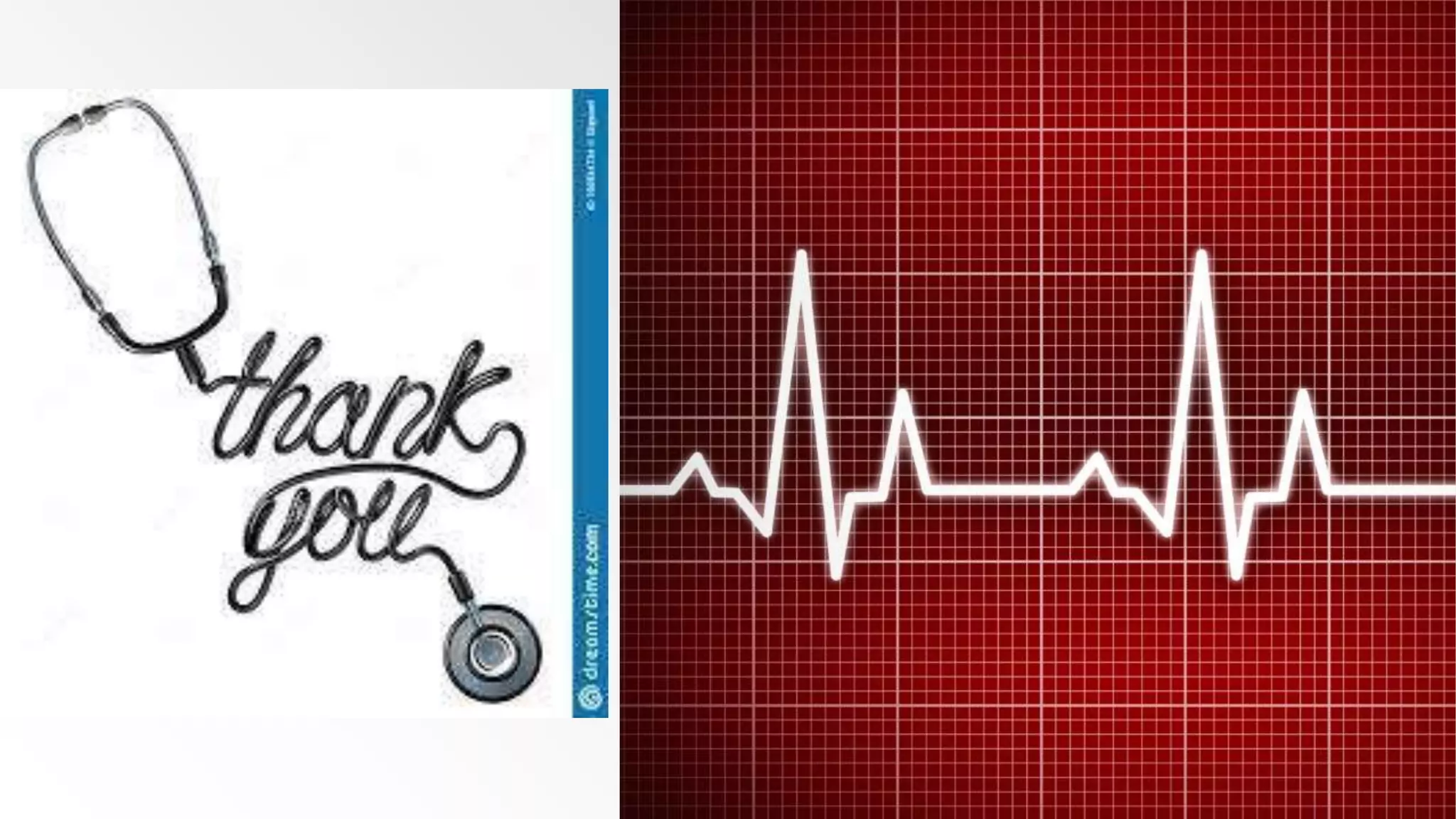 HEART RATE SENSOR USING LM358 | PPTX