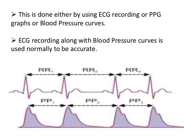 Heart rate variability