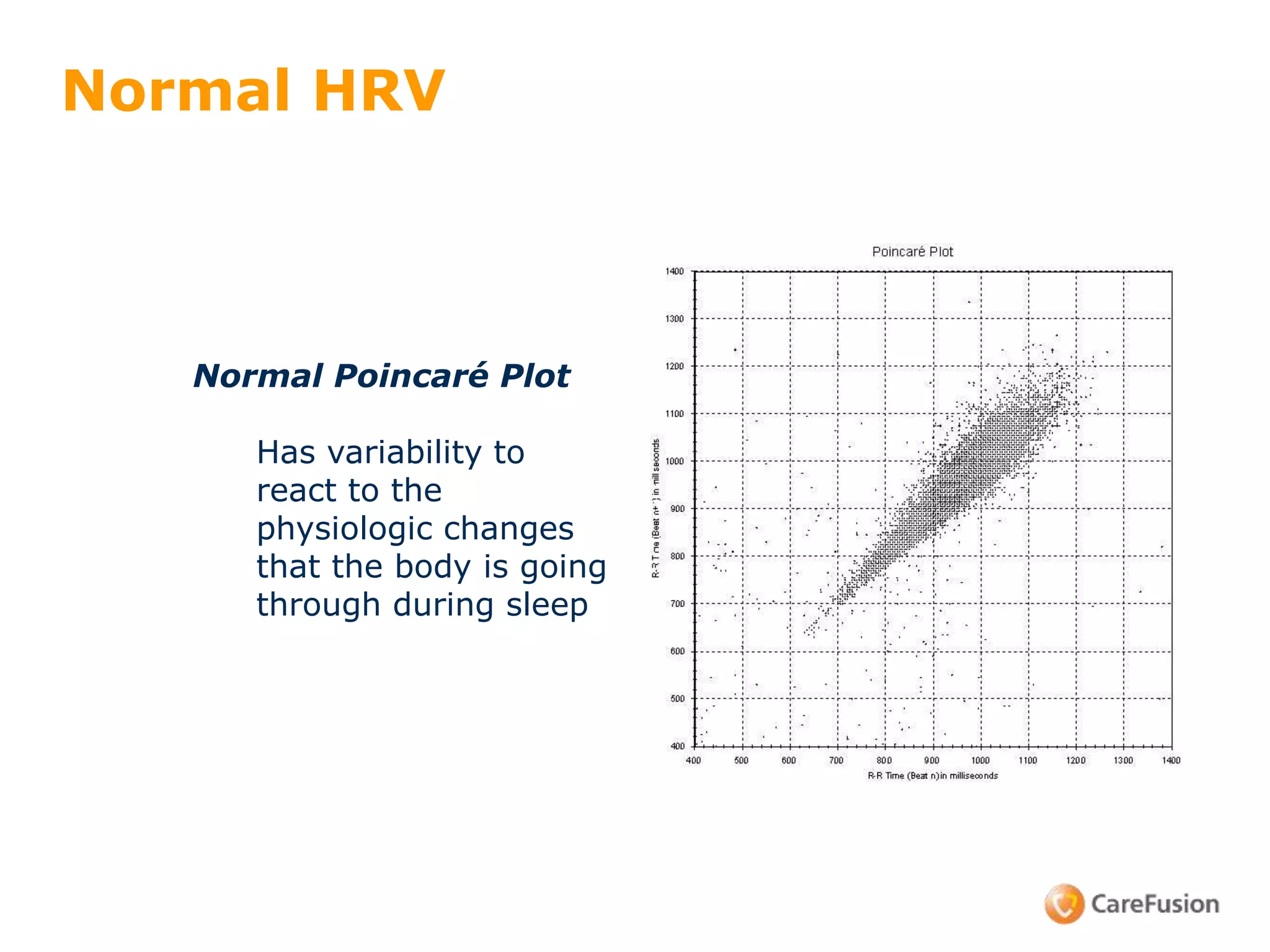 Heart rate variability guide carefusion | PPTX