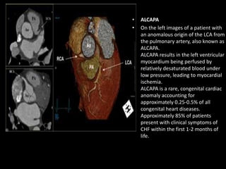 Hearts crown living pipes | PPT