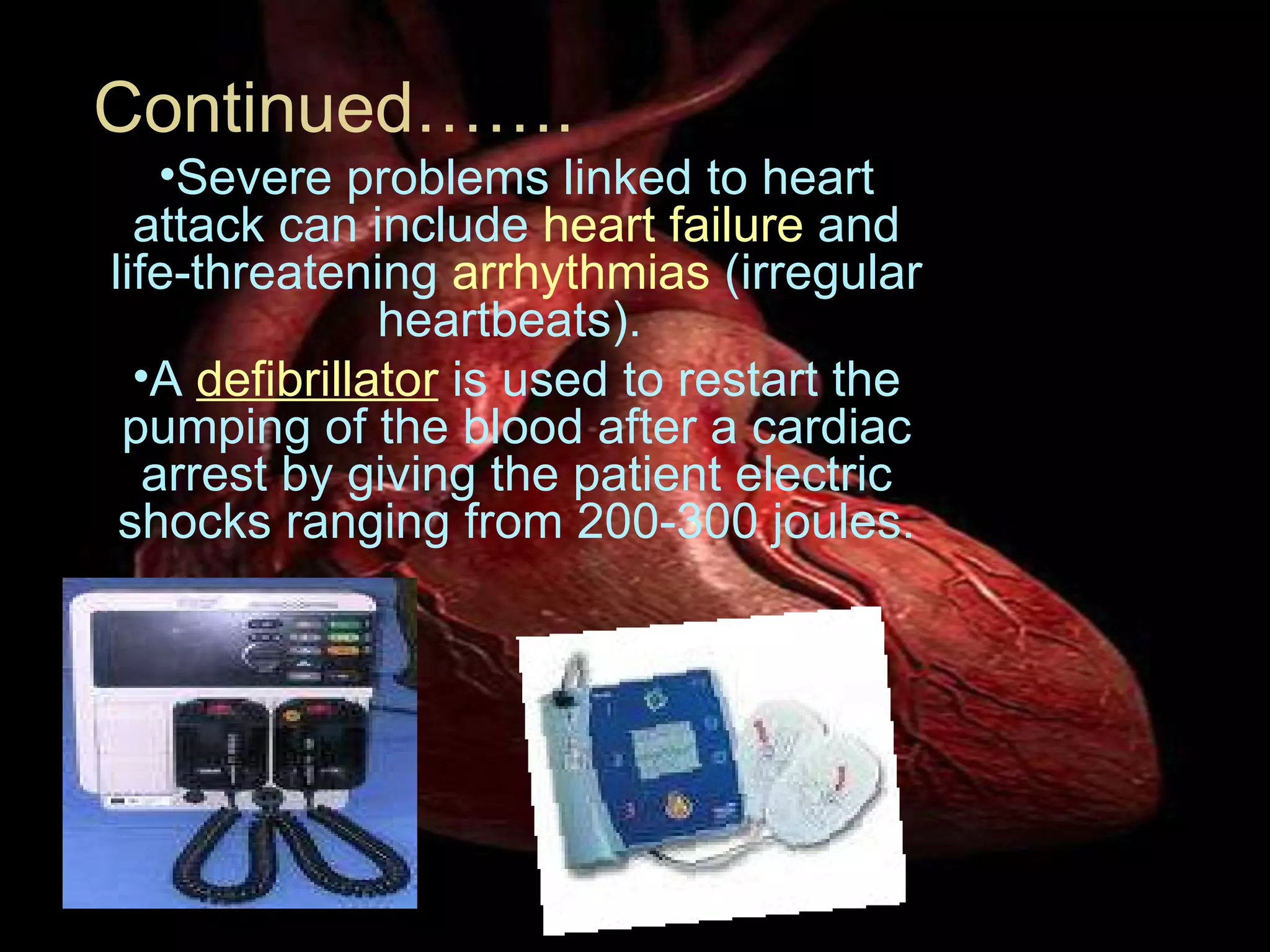 Heart Slides | PPT