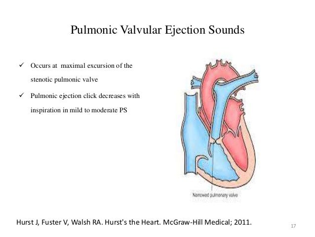 Heart sounds