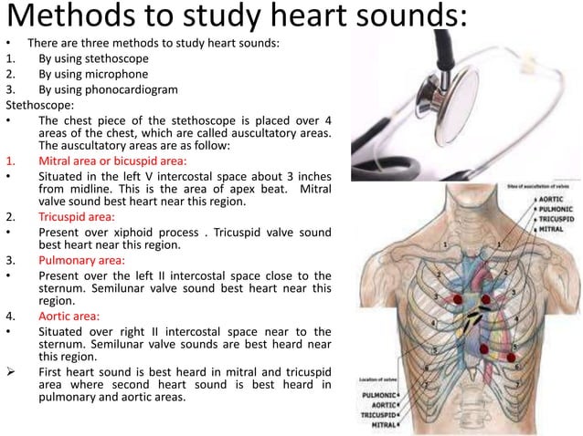 Heart sounds