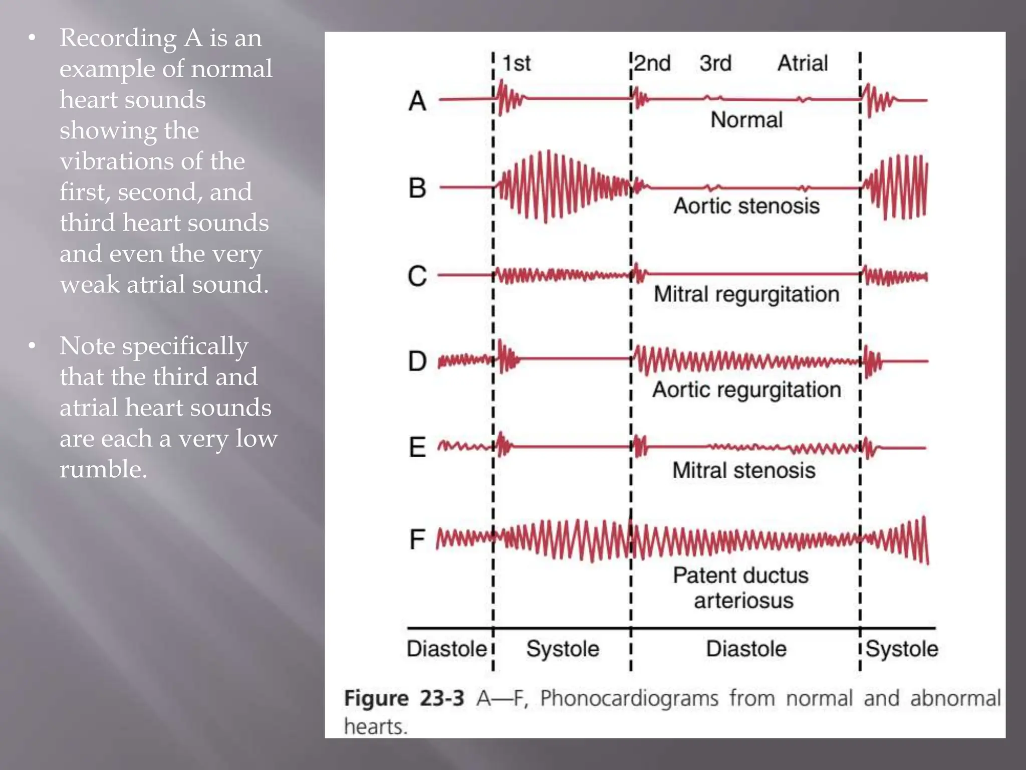 Heart Sounds.Cardiovascular system by Dr Farhan KGMC peshawar | PPTX