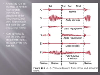 Heart Sounds.Cardiovascular system by Dr Farhan KGMC peshawar | PPT