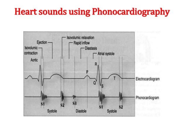 heart sounds, auscultation , points basics | PPT