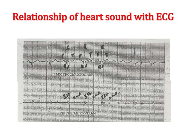 heart sounds, auscultation , points basics | PPT