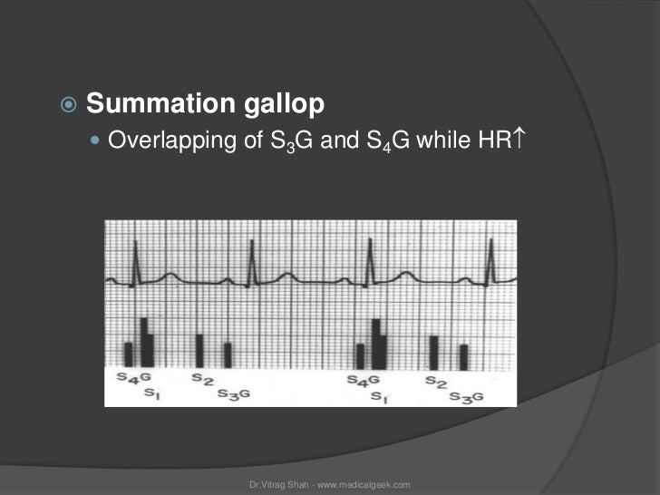 Heart sounds and murmur
