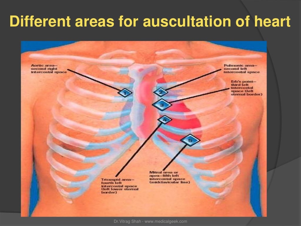 Heart Sounds And Murmur