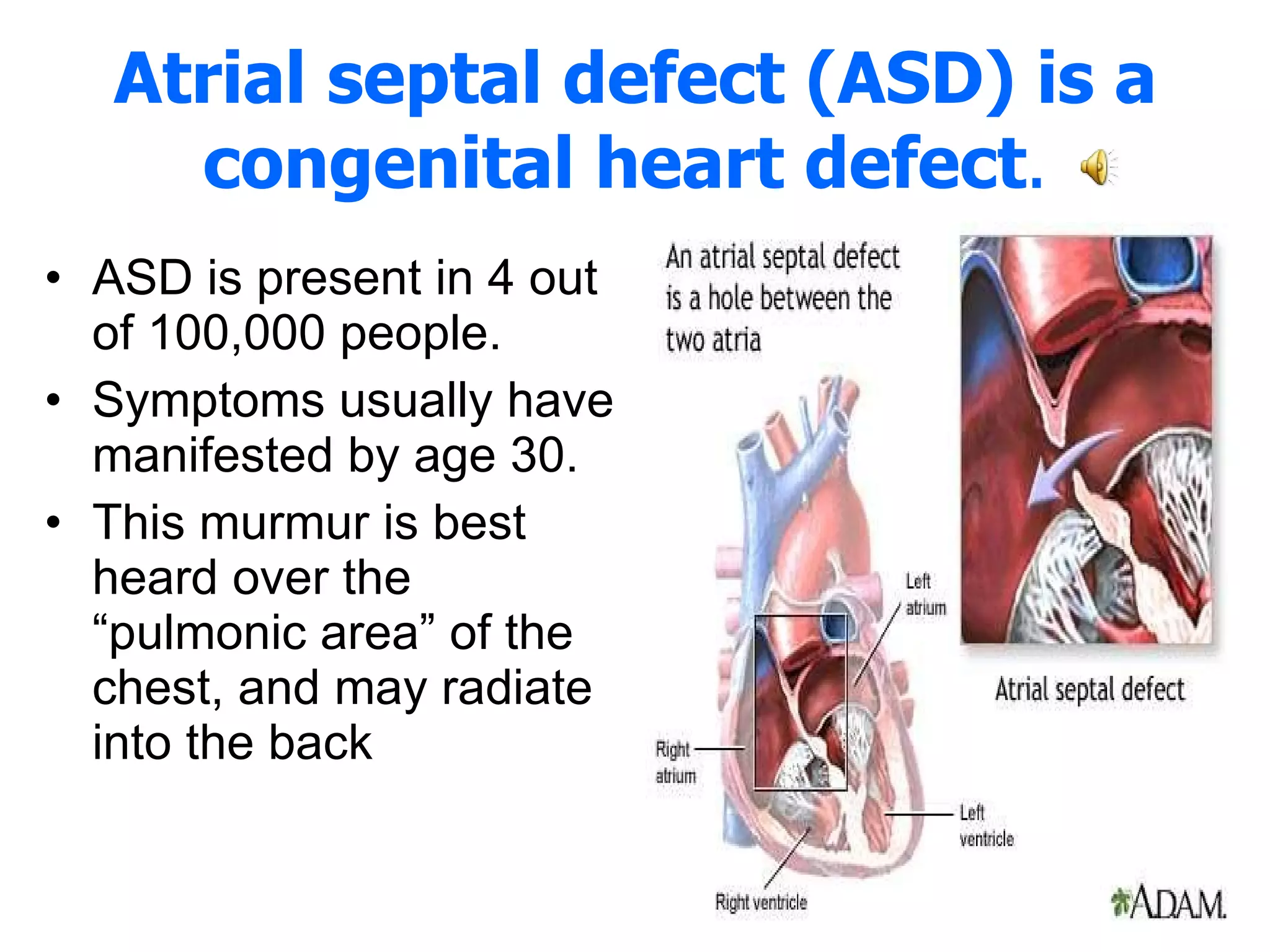 Heart Sounds And Murmurs | PPT