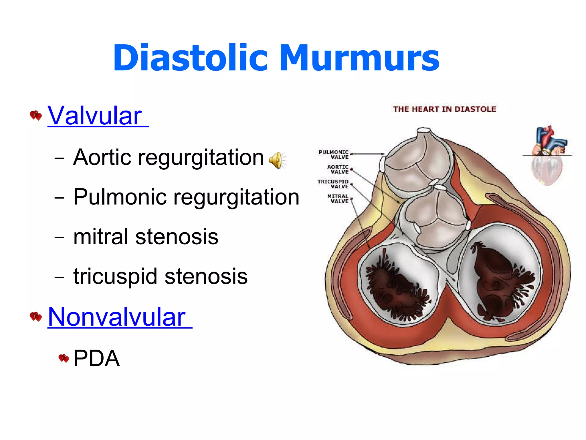 Heart Sounds And Murmurs | PPT