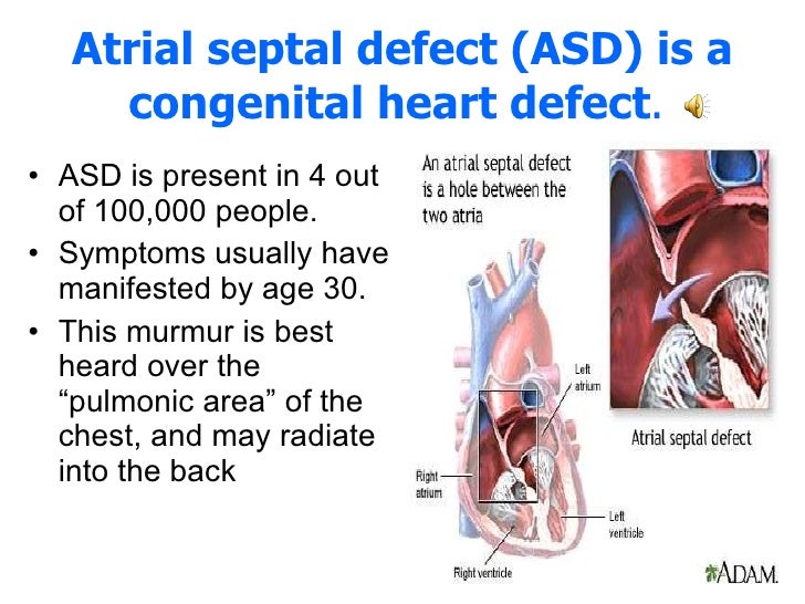 Heart Sounds And Murmurs