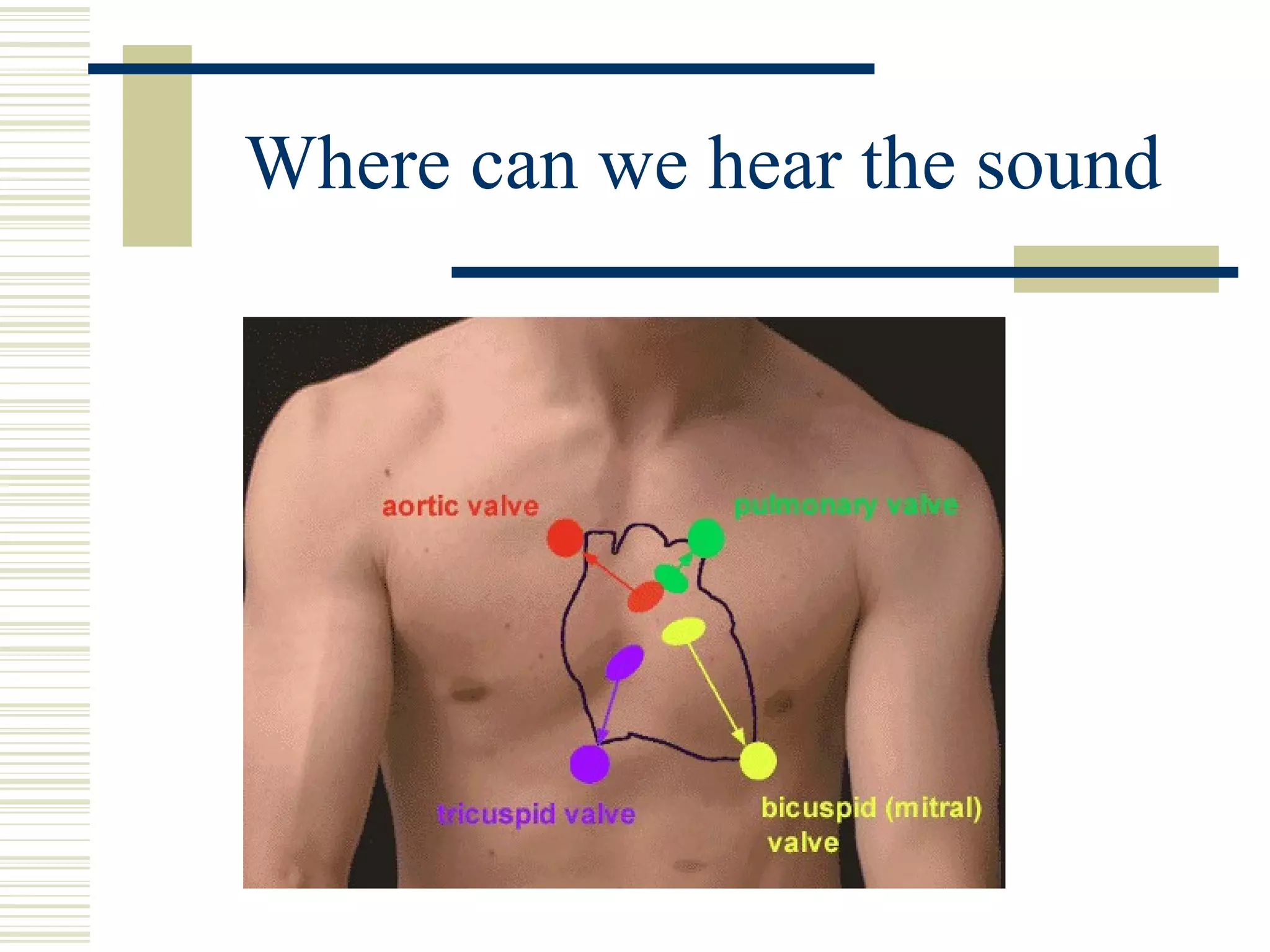 Heart sounds and murmurs | PPT
