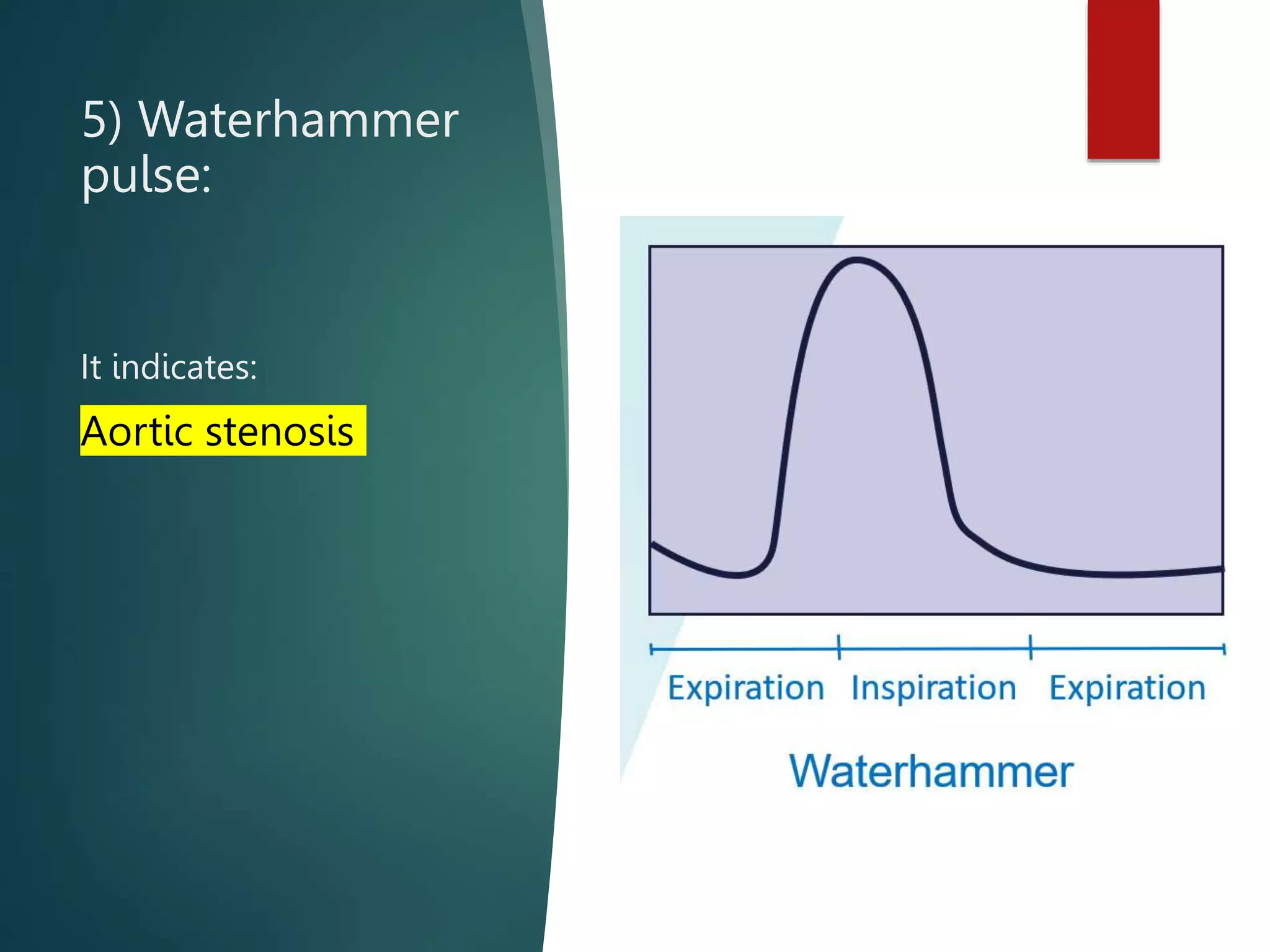 Heart Sounds And Pulse, Abnormalities; Physiology Y2B2.pptx