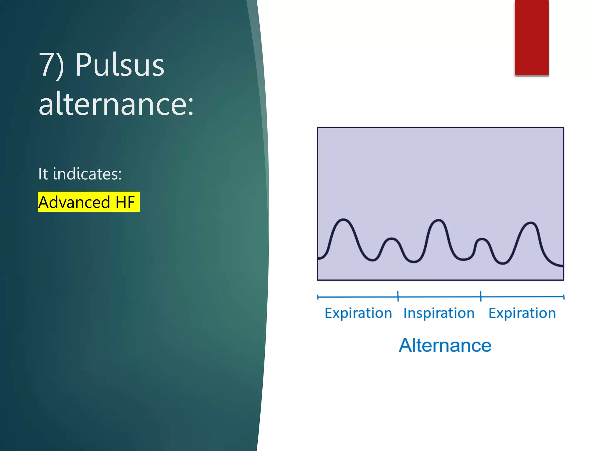 Heart Sounds And Pulse, Abnormalities; Physiology Y2B2.pptx