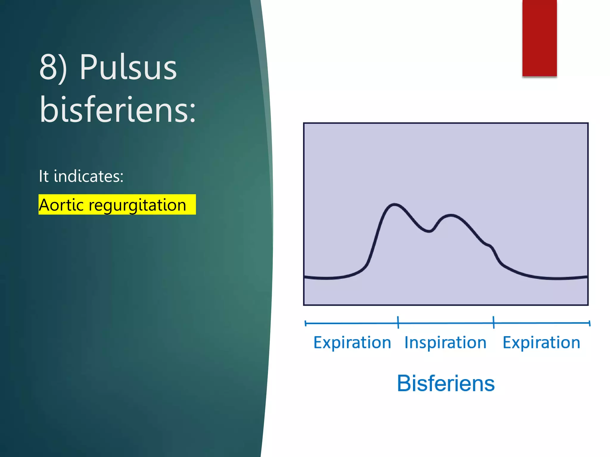 Heart Sounds And Pulse, Abnormalities; Physiology Y2B2.pptx