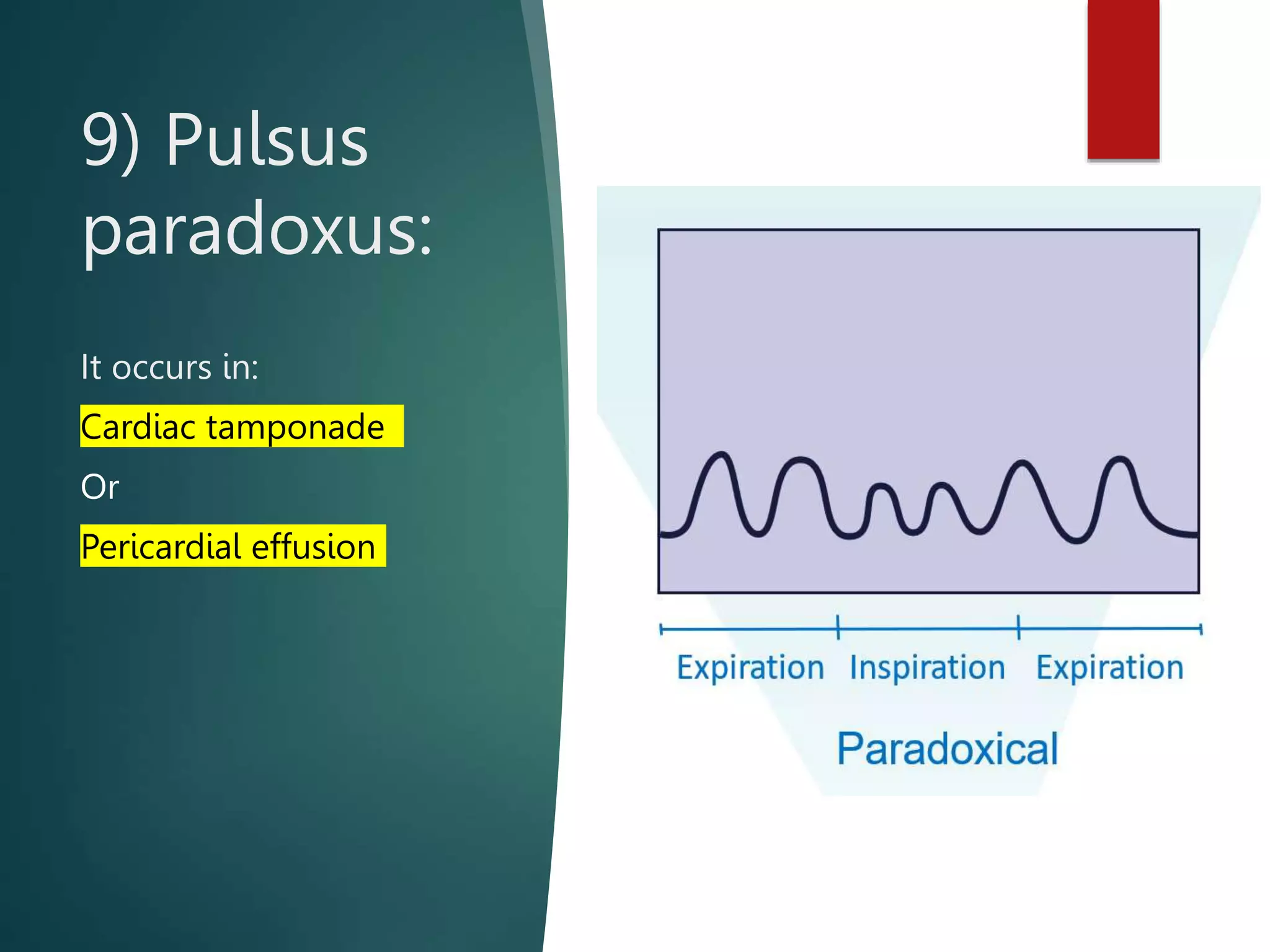 Heart Sounds And Pulse, Abnormalities; Physiology Y2B2.pptx