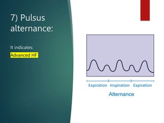 Heart Sounds And Pulse, Abnormalities; Physiology Y2B2.pptx