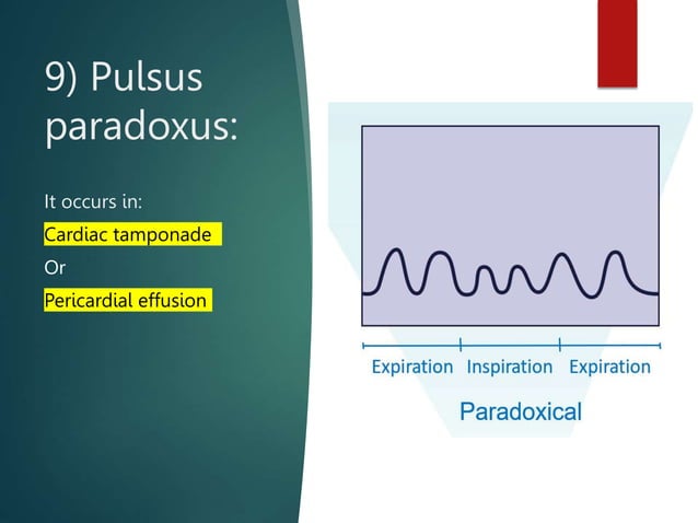 Heart Sounds And Pulse, Abnormalities; Physiology Y2B2.pptx