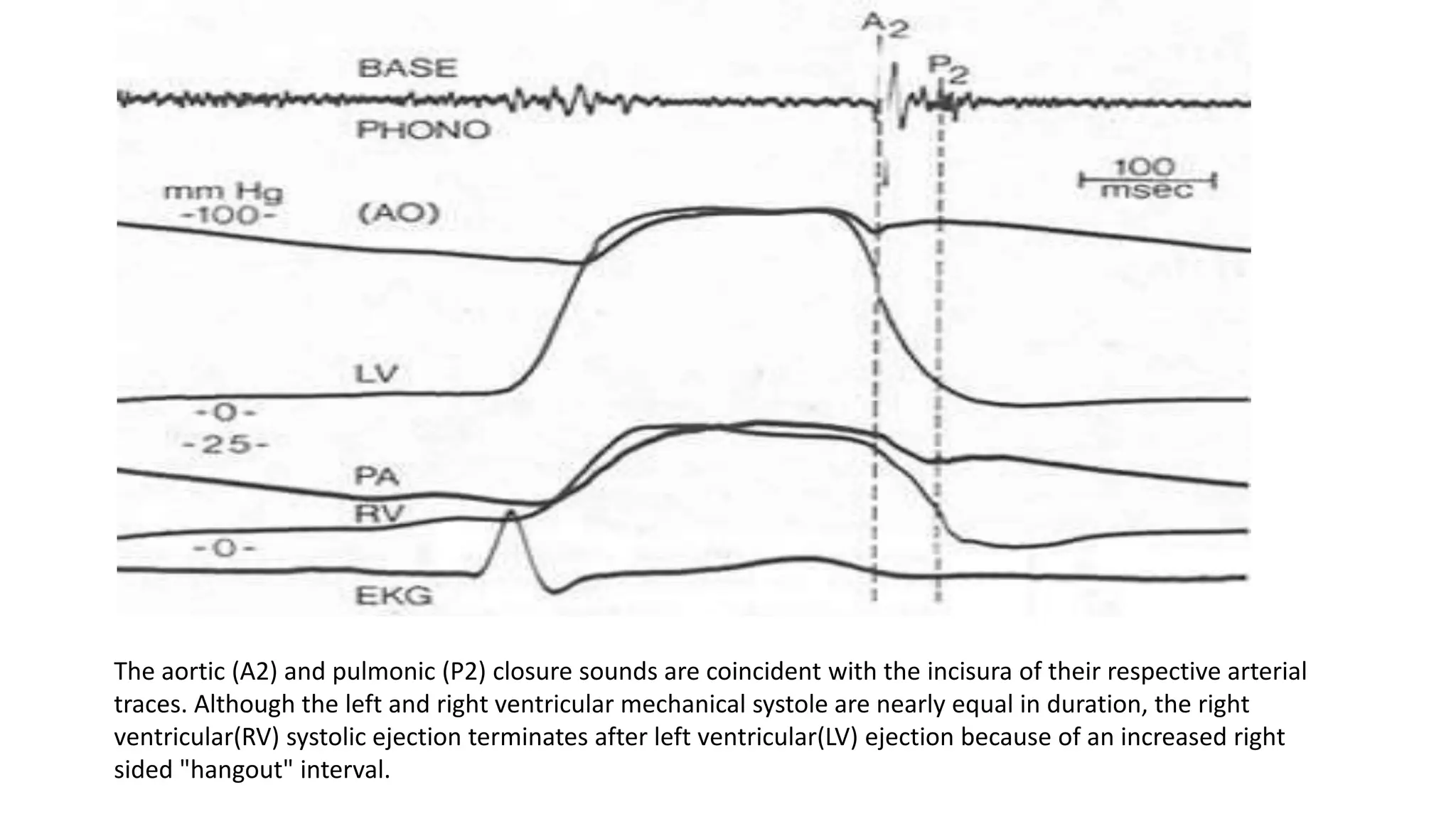 Heart sounds,murmurs & Dynamic auscultation.pptx