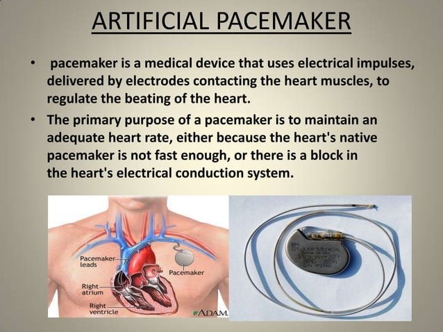 Heart’s pace maker, the sinoatrial node | PPTX