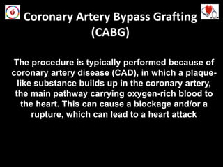 Heart surgery | PDF