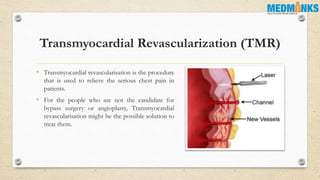 Heart Surgery in India | MedMonks | PPT