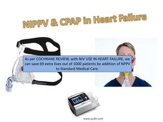 VENTILATORY STRATEGY IN HEART FAILURE | PPTX