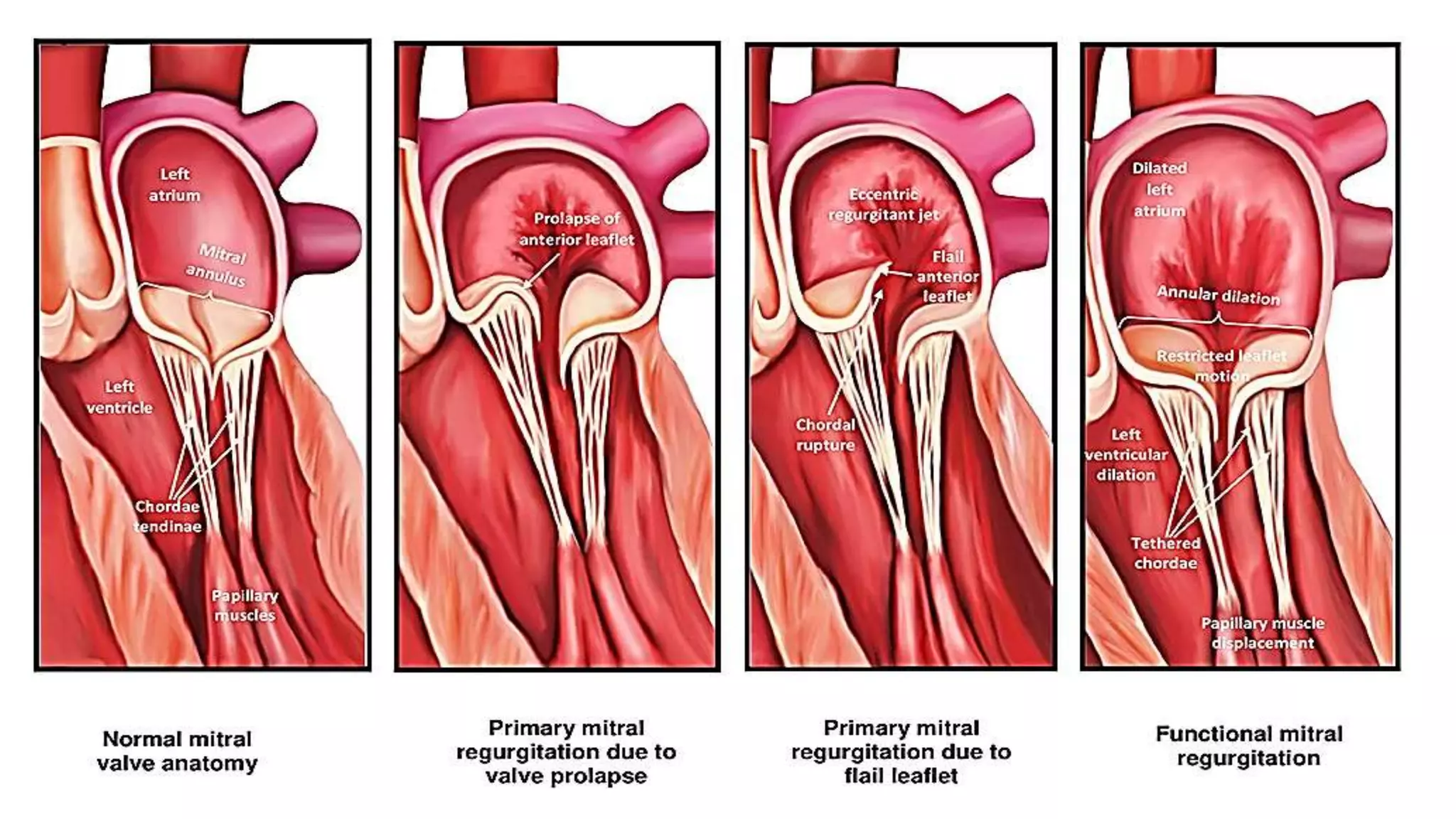 Heart valves- A detailed medical information about heart valves . | PPTX