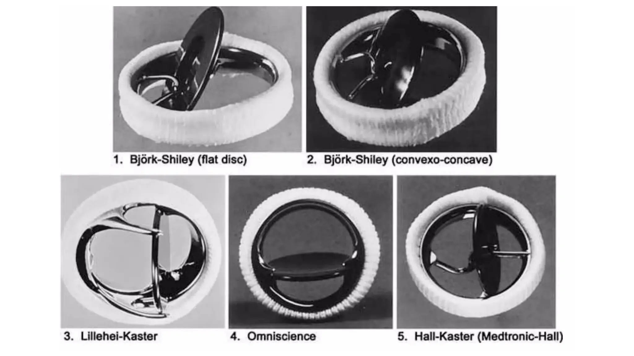ANATOMY OF HEART VALVES AND PROSTHETIC VALVES.pptx