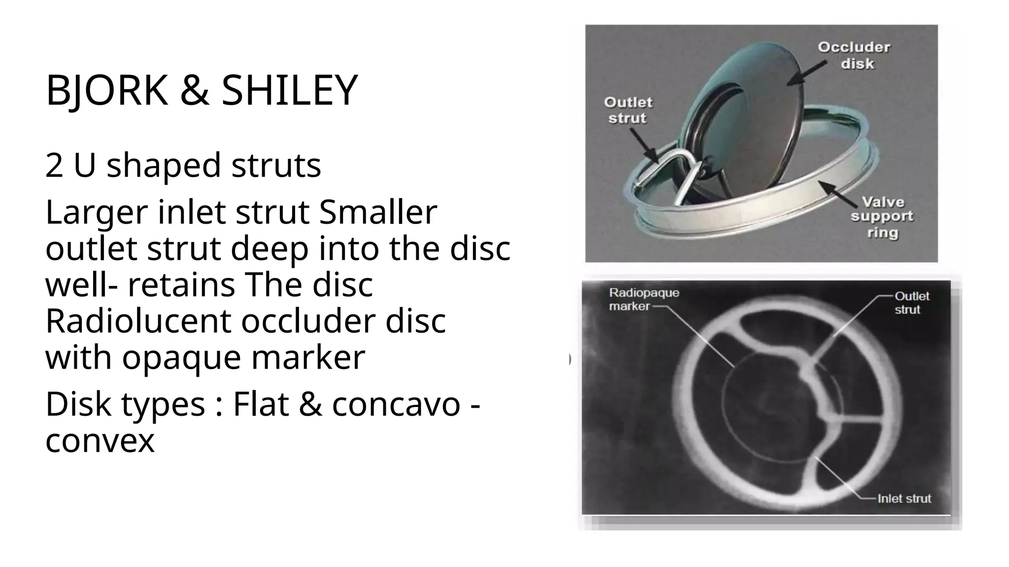 ANATOMY OF HEART VALVES AND PROSTHETIC VALVES.pptx