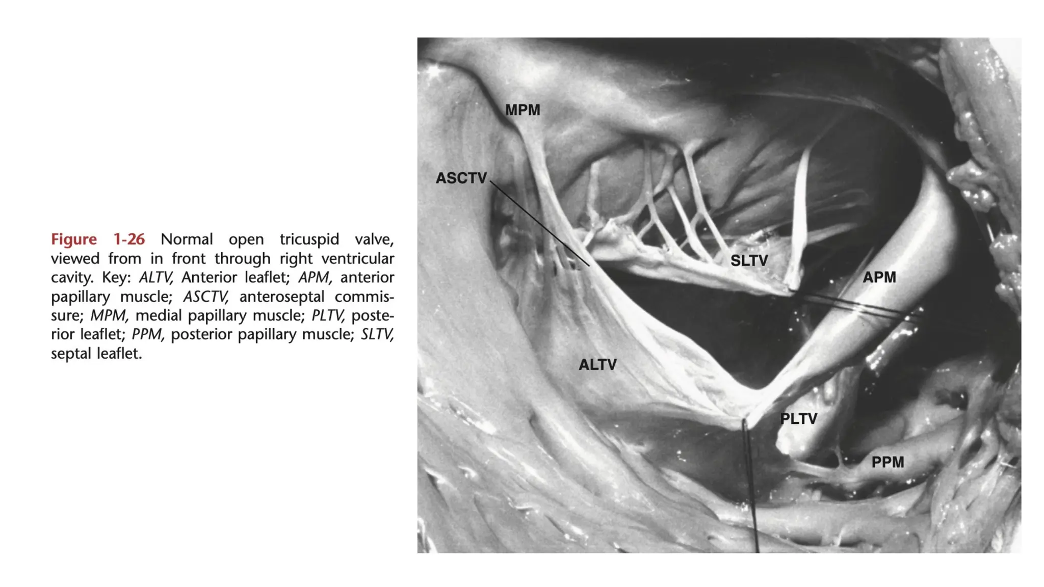 ANATOMY OF HEART VALVES AND PROSTHETIC VALVES.pptx