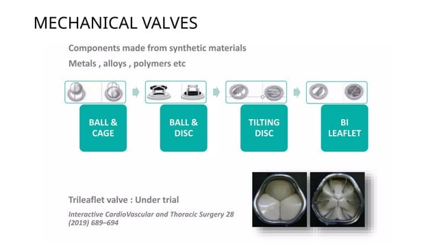 ANATOMY OF HEART VALVES AND PROSTHETIC VALVES.pptx