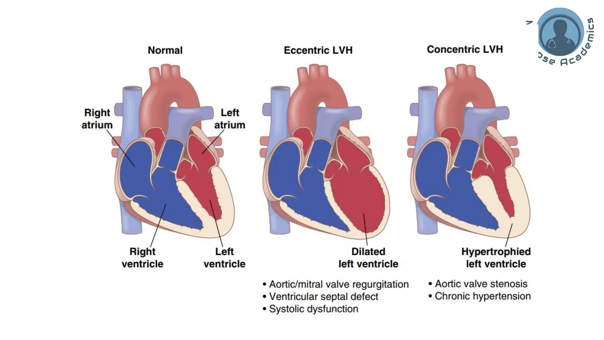 Heart Valves and Heart Sounds -Congenital & valvular heart disease.pdf