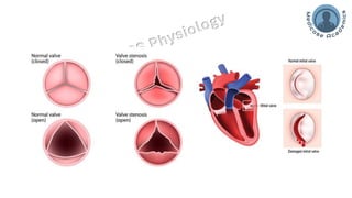 Heart Valves and Heart Sounds -Congenital & valvular heart disease.pdf